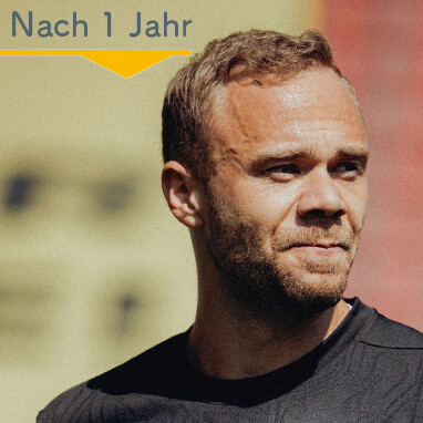 Haartransplantation von Alexander Schlager | Moser Medical